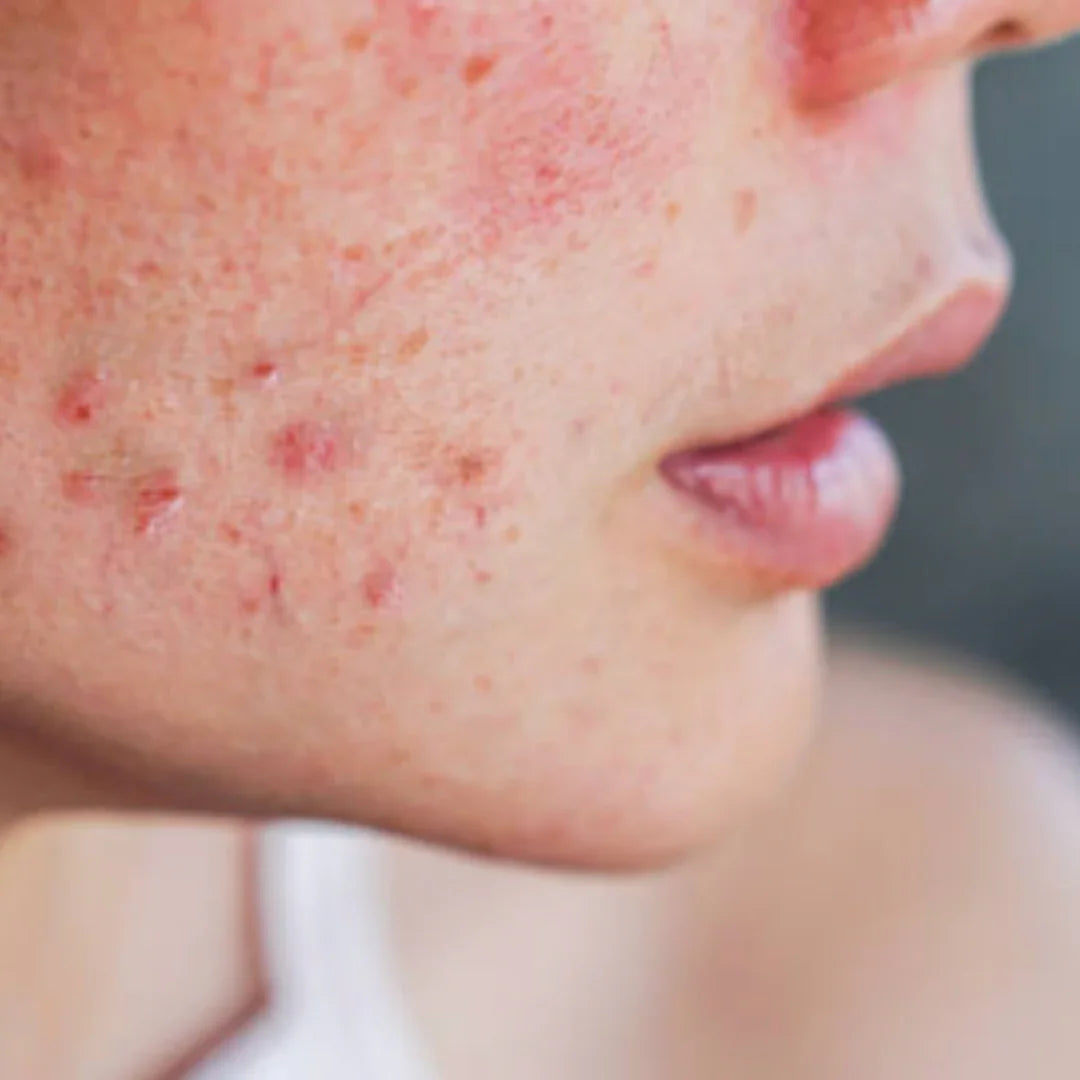 Caring for Your Skin: Facts and Tips for Optimal Health – LUXWORKS